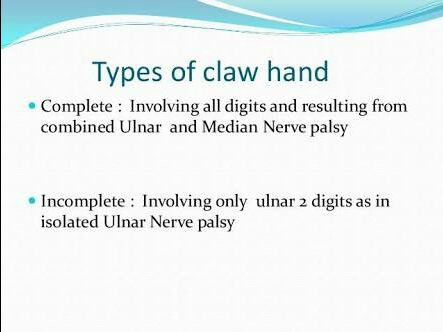 CLAW HAND TYPES