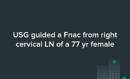USG guided a Fnac from right cervical LN of a 77 yr female