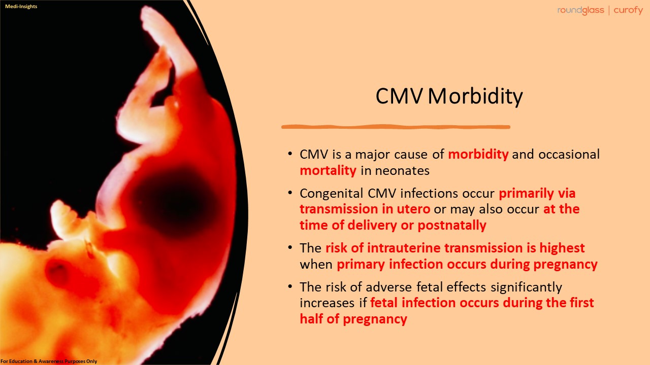 Congenital CMV - Clinical Features