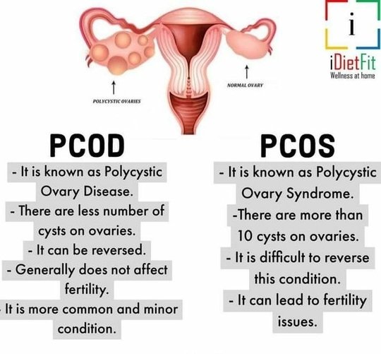 Polycystic Ovarian Disease