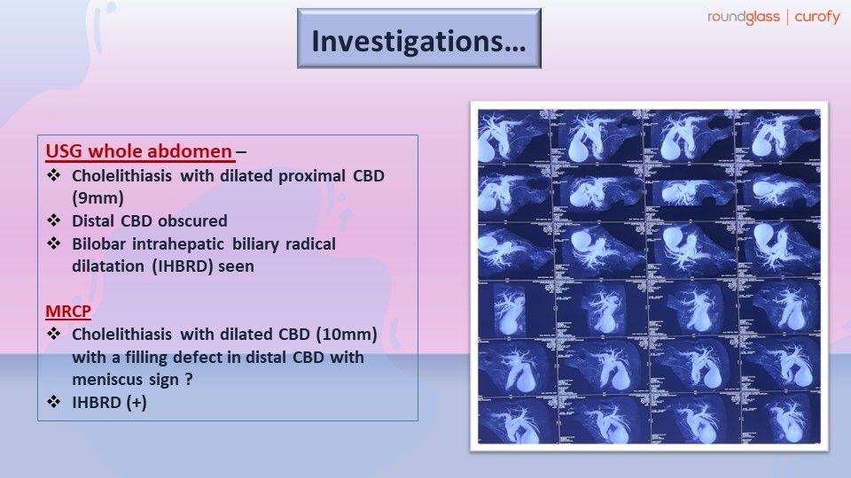 A case of Extrahepatic Biliary Tract Obstruction with CBD Stone, Septic Shock & Cholangitis
