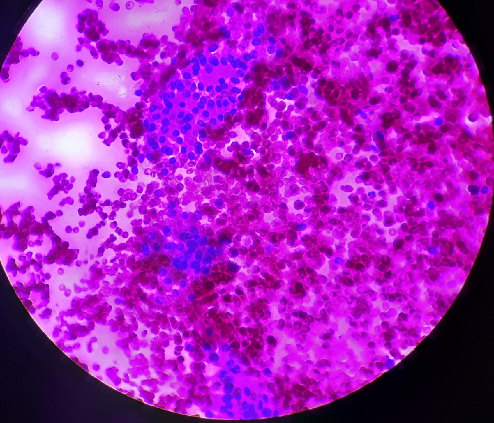 FINE NEEDLE ASPIRATION CYTOLOGY