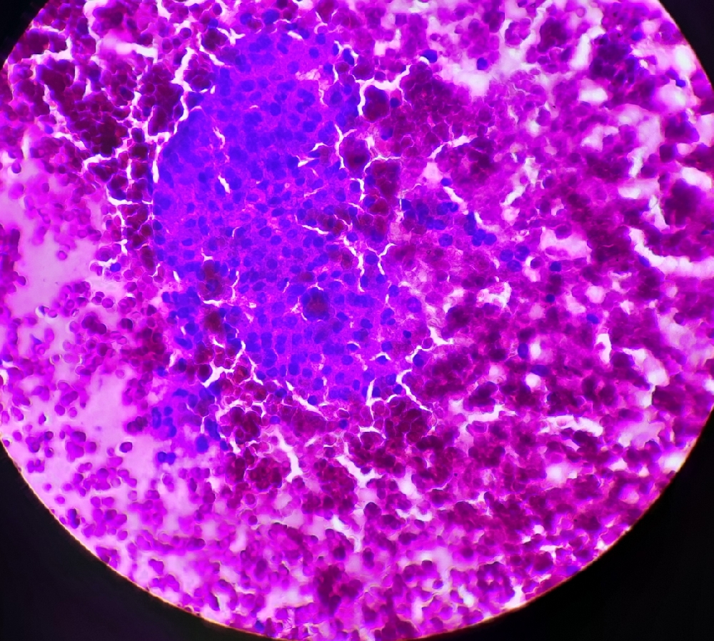 FINE NEEDLE ASPIRATION CYTOLOGY