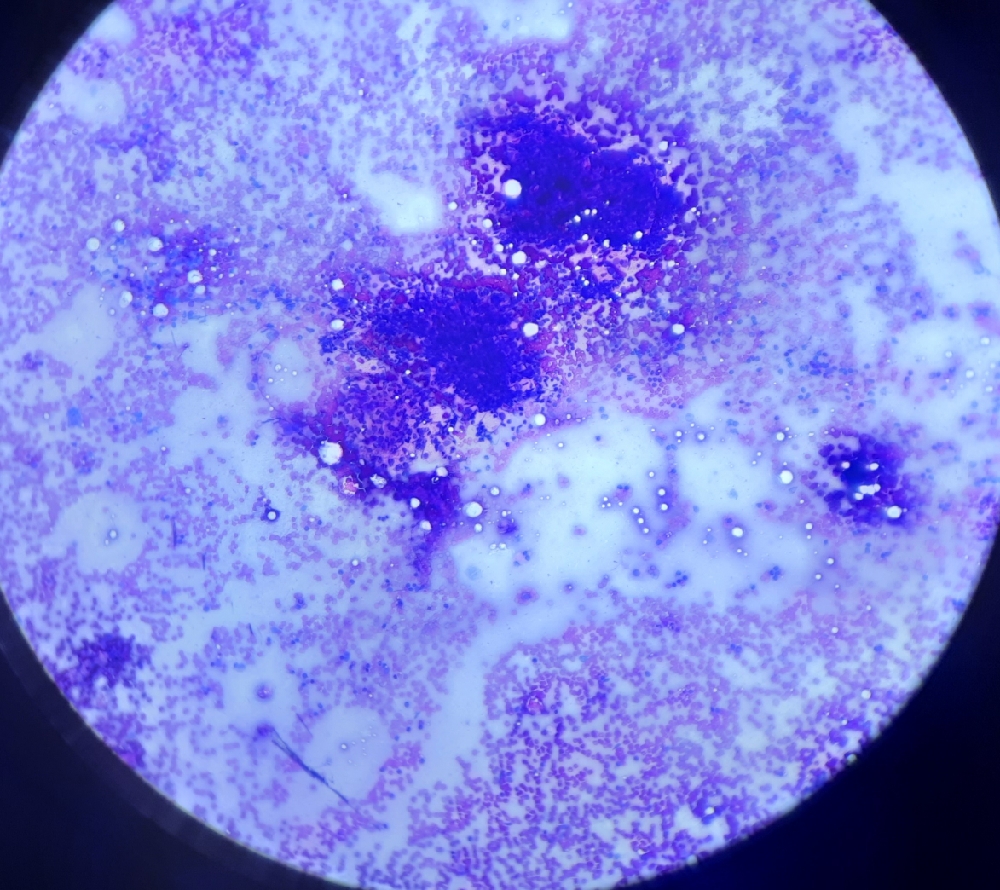 FINE NEEDLE ASPIRATION CYTOLOGY